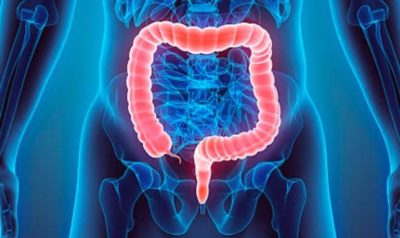 What is a Virtual Colonoscopy? | Preventative Diagnostic Center