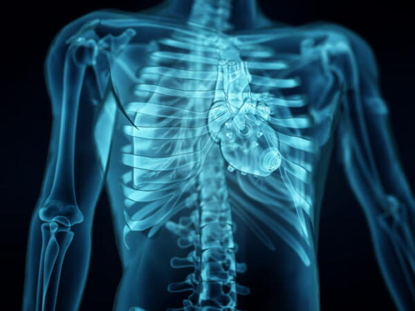 Heart CT Scan: How Long? | Preventative Diagnostic Center